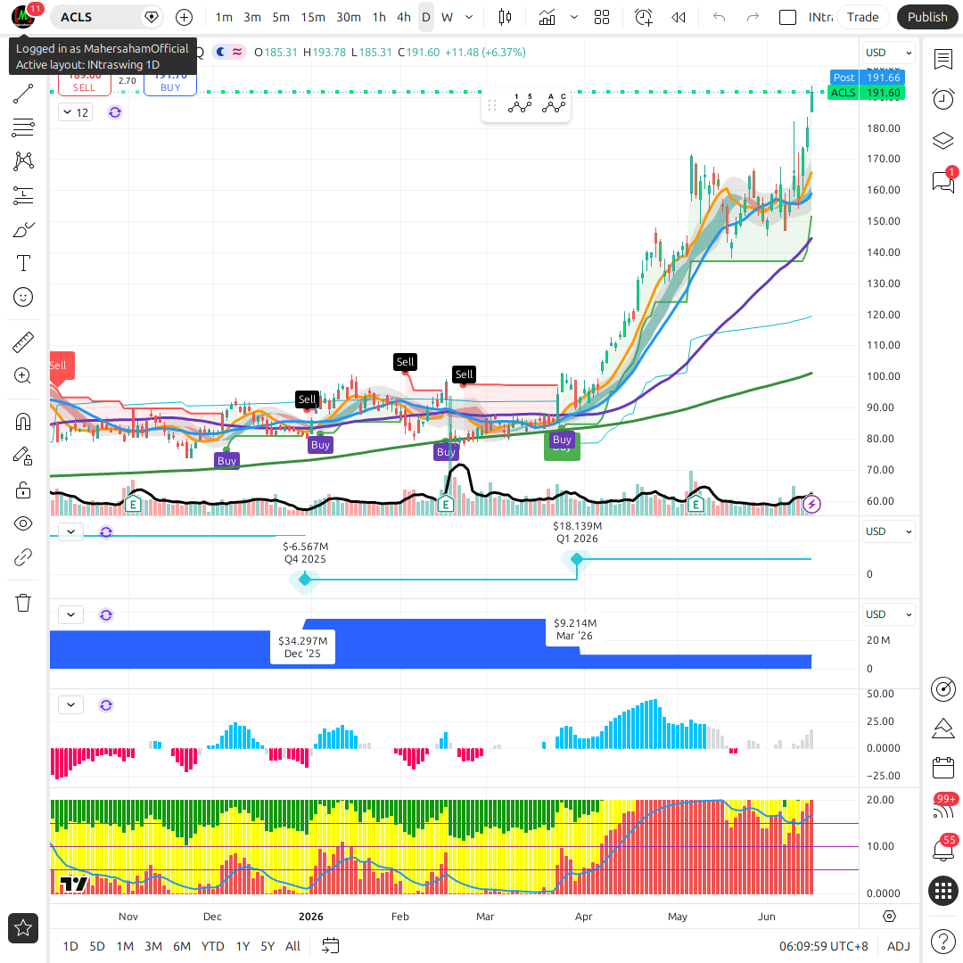 ACLS Stock Analysis: Axcelis Technologies 2026 | Maher Saham | Mahersaham